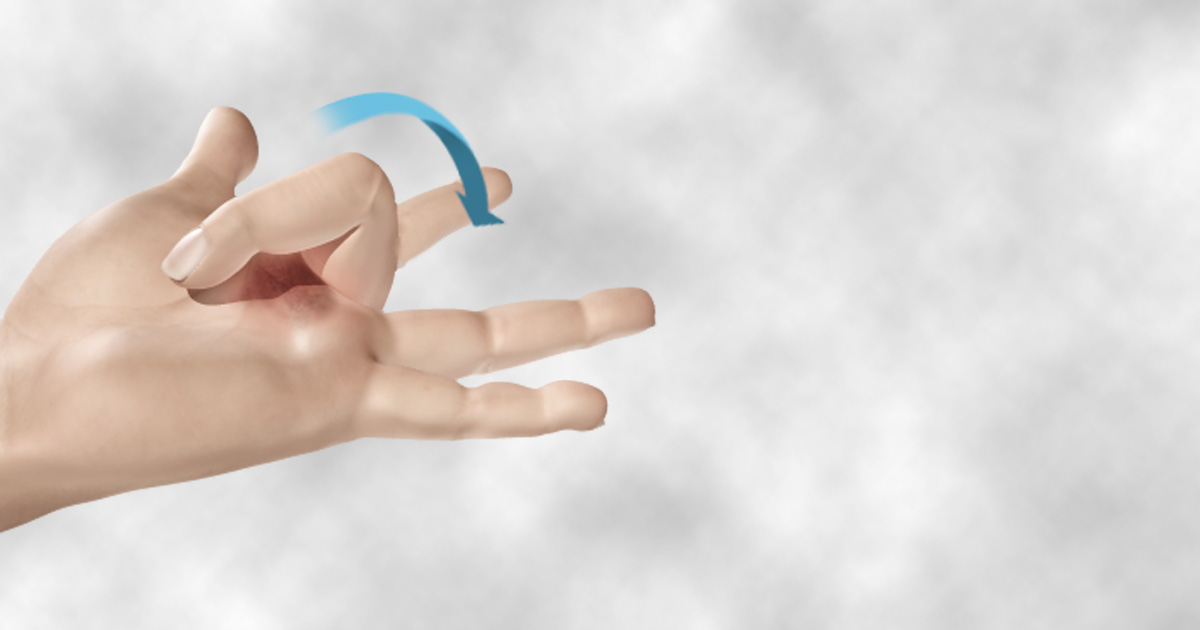 Trigger Finger Treatment San Diego, CA | Finger Pain Coronado, Carlsbad